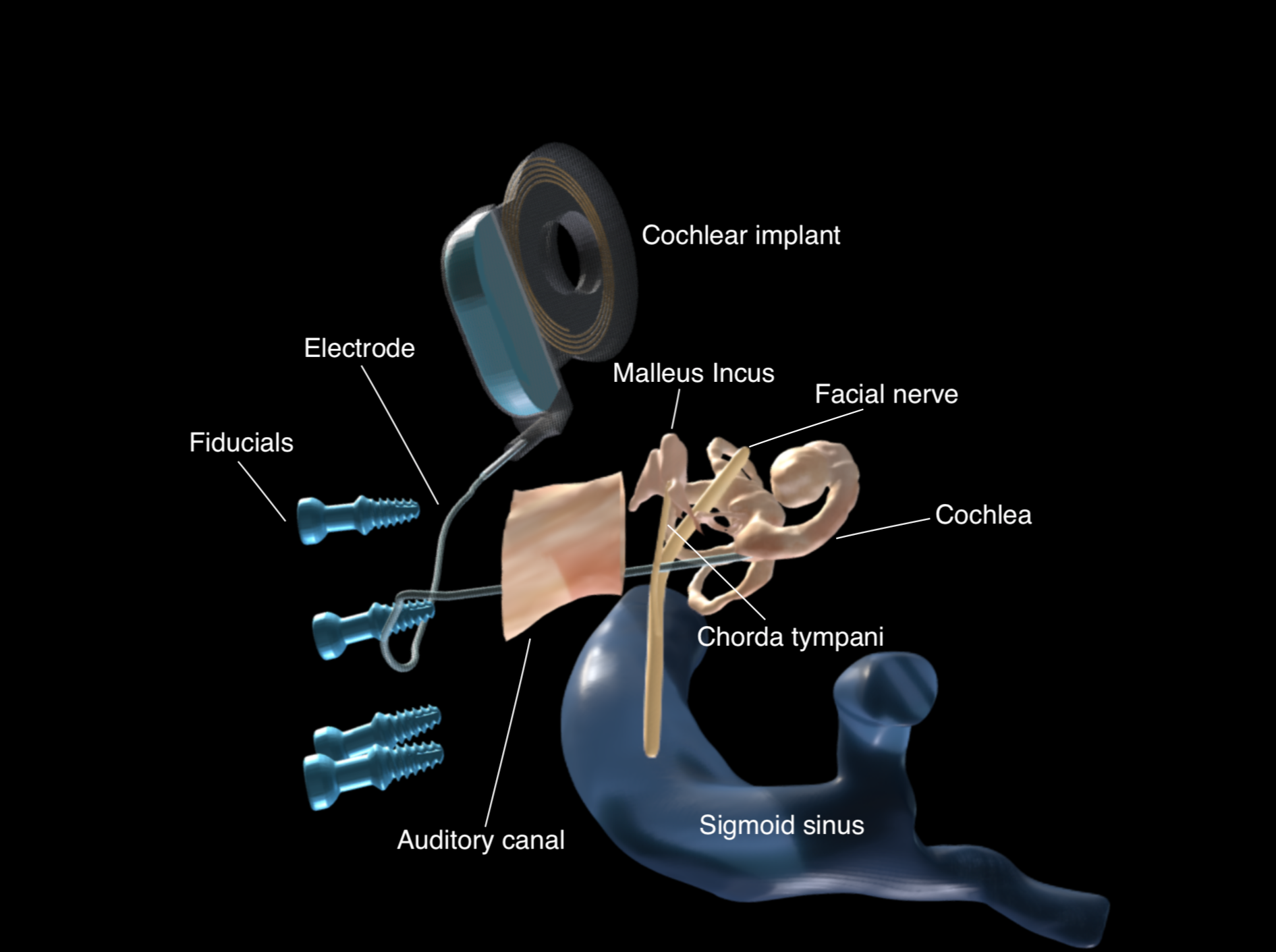 Journey to the Inner Ear – Master Knowledge Visualization